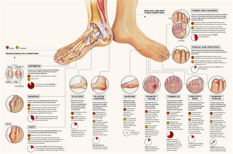 Pin On Health Tips Exercises Stretches Kkt Pakistan