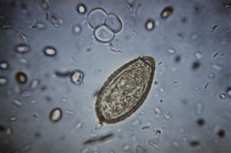 Parasitology 101 Clonorchis Sinensis