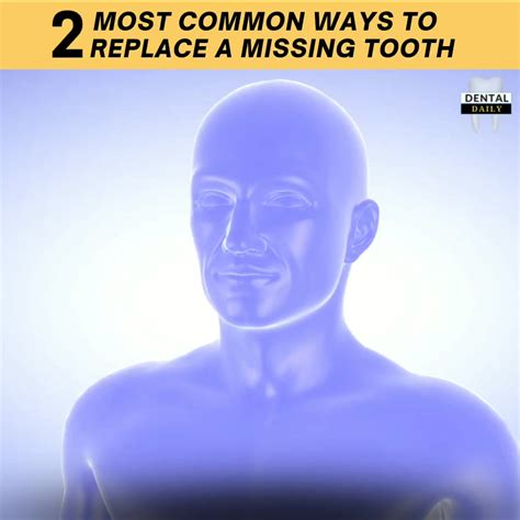 2 Most Popular Ways Of Replacing A Missing Tooth Dental Animation