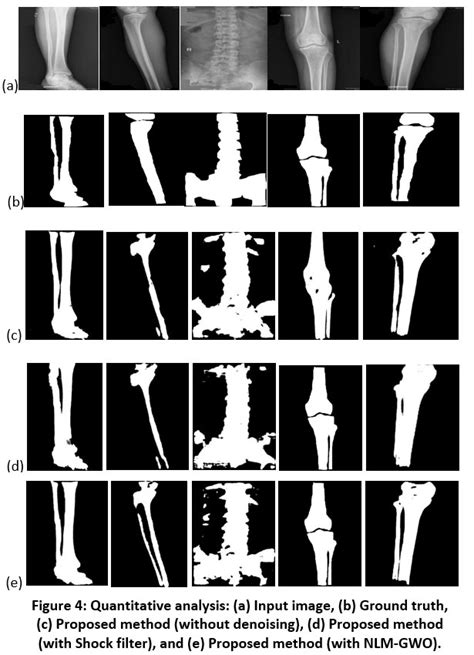 Grey Wolf Optimization Guided Non Local Means Denoising For Localizing