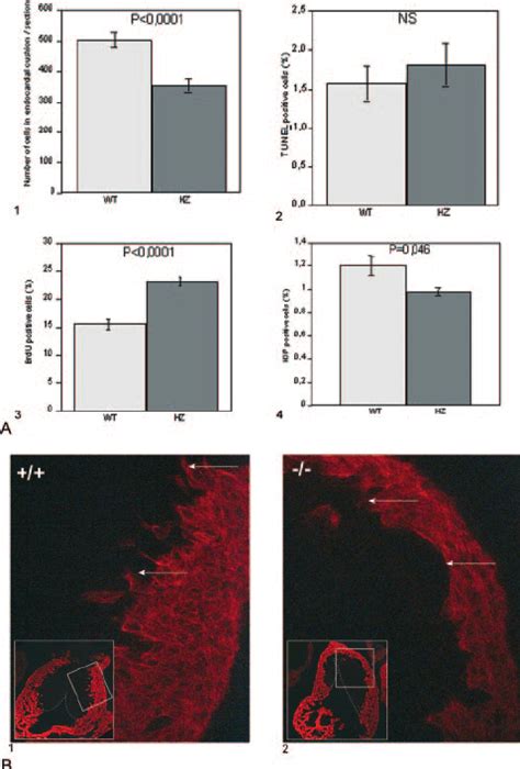 Endocardial Cushion Development A Proliferation And Apoptotic Death Download Scientific