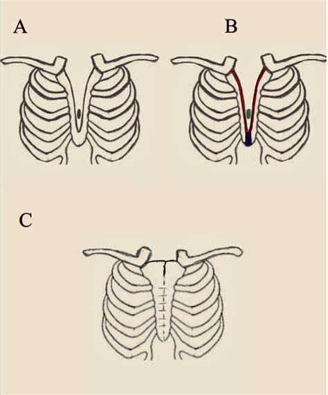 Muhammad Taimour Khan Md On Linkedin Medicalillustration