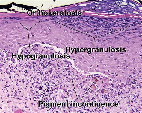 The Basics Diagnostic Terms Skin Anatomy And Stains Clinical Tree