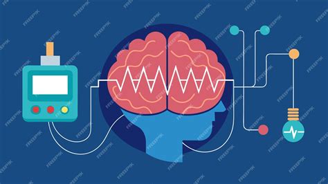 Uma Visualização Do Dispositivo De Estimulação Cerebral Profunda Que