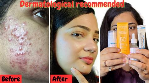Dermatologists Recommended Skincare Products From Amazon Retino A 0