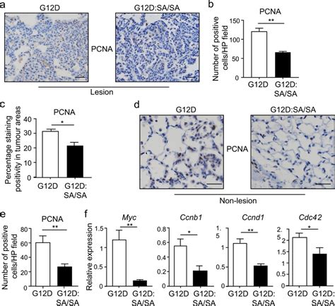 Ps727 Stat3 Deficiency In The Krasg12d Lac Mouse Model And Human Lac