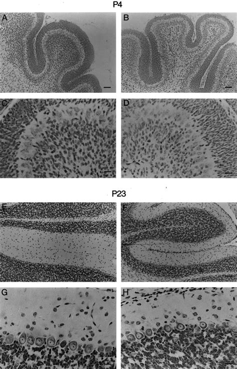 Paraffin Sections Of Cerebellum Stained With Cresyl Violet P4 Pups Are Download Scientific
