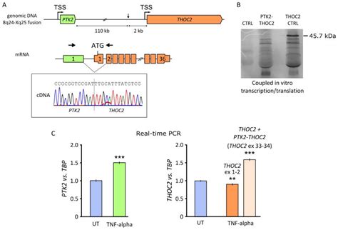A De Novo X 8 Translocation Creates A Ptk2 Thoc2 Gene Fusion With Thoc2 Expression Knockdown In