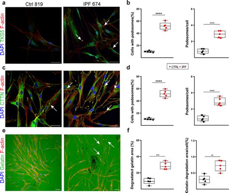 The Formation Of Extracellular Matrix Ecm Degrading Podosome Rosettes Download Scientific