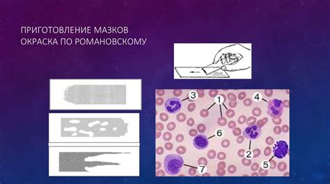 Морфологическое исследование крови презентация онлайн