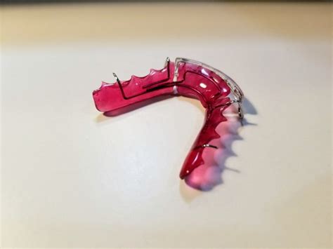 Live Wire Wednesday Unique Spring Aligner Retainer Designer