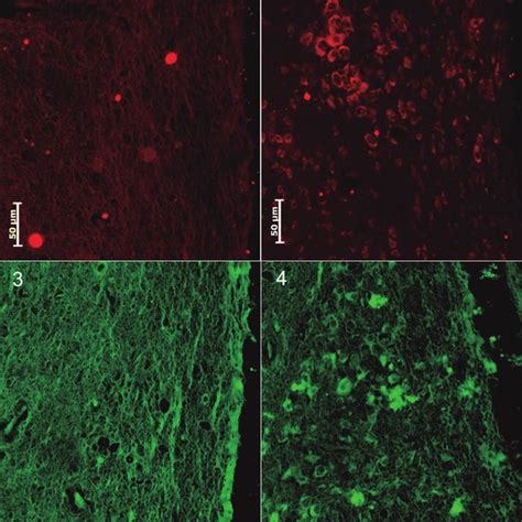 Cfos And Crh Immunofluorescent Staining In The Paraventricular Nucleus Download Scientific
