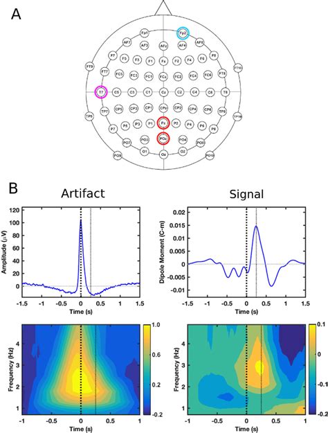 Figure From Novel Signal Processing Technique For Capture And Isolation Of Blink Related
