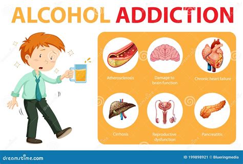 Información Sobre Adicción Al Alcohol O Alcoholismo Infográfica Stock