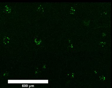 Fluorescence Image Of A Huh7 Microarray LIFT Printed Onto A Porous