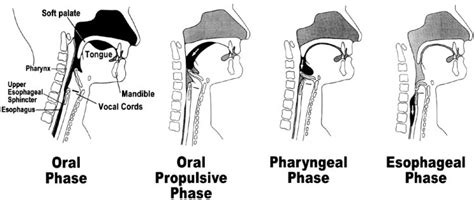 What Is Oral Phase Dysphagia At Jayden Nobbs Blog