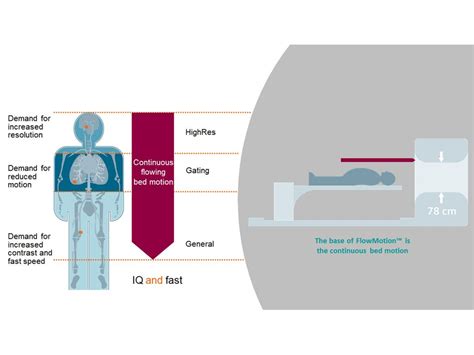Biograph Horizon Flow Edition Siemens Healthineers Brasil
