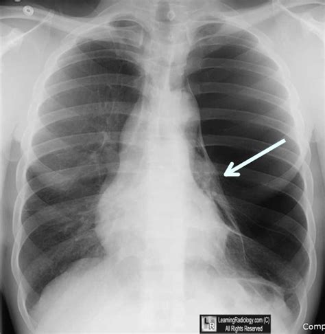 Learningradiology
