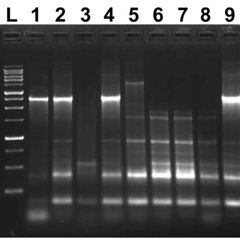 Eric Pcr Fingerprint Patterns Of P Larvae Isolates On 1 Agarose Gel