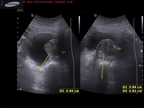 A Gallery Of High Resolution Ultrasound Color Doppler And 3d Images