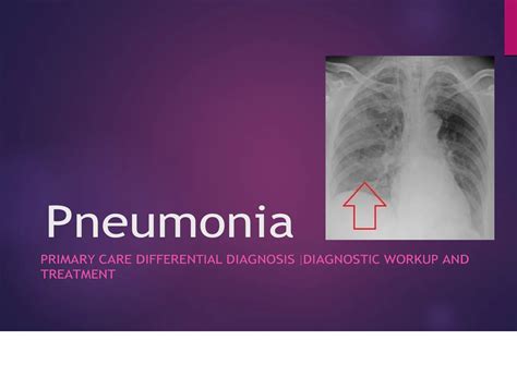 Pneumonia Primary Care Differential Diagnosis Diagnostic Workup And