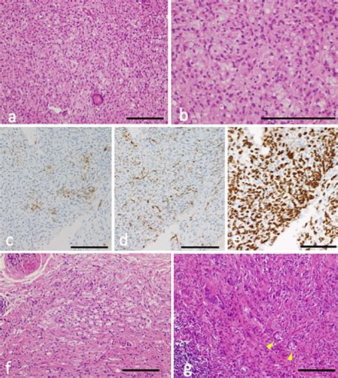 Figure4the Histological Findings Of The Duodenal Biopsy Specimens