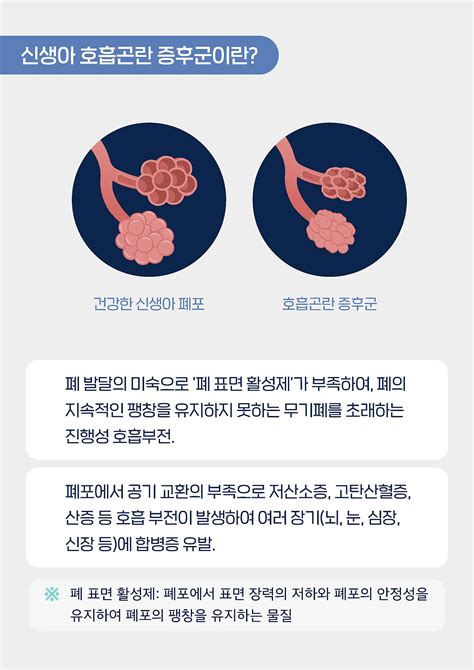 신생아 호흡 곤란 증후군 네이버 포스트