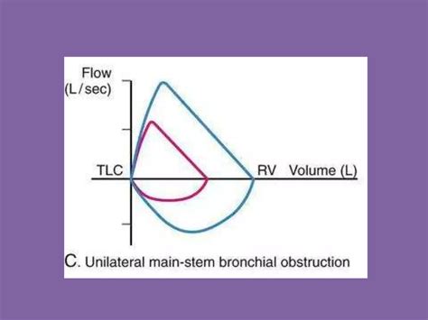 Pulmonary Flow Volume Loops Dr Padmesh Pptx