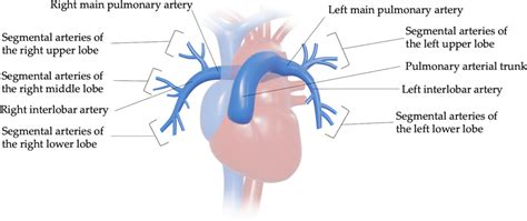 The Pulmonary Artery And Its Branches Download Scientific Diagram