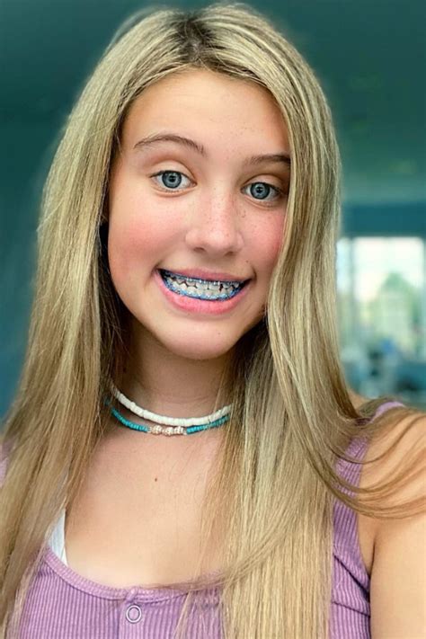 Cheeks Exposed666