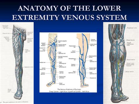 Ppt Chronic Venous Insufficiency Cvi Powerpoint Presentation Free