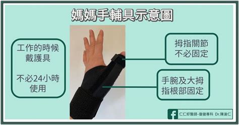 我得了媽媽手嗎？復健醫教1分鐘判斷法：按壓、握拳「有劇痛」當心 民生頭條