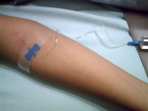 Injections Psychology Wiki Fandom Powered By Wikia