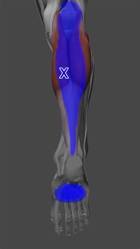 Acupuncture For Calf Trigger Points — Morningside Acupuncture Nyc