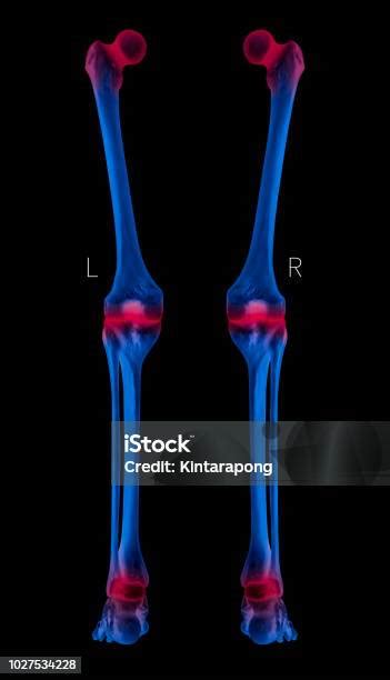 X선 인간의 다리 뼈 후부 관절염 다리 관절 통증 영역3d 의료 및 생물 그림건강 관리인간 해부학 및 의료 개념블루 톤 색상에