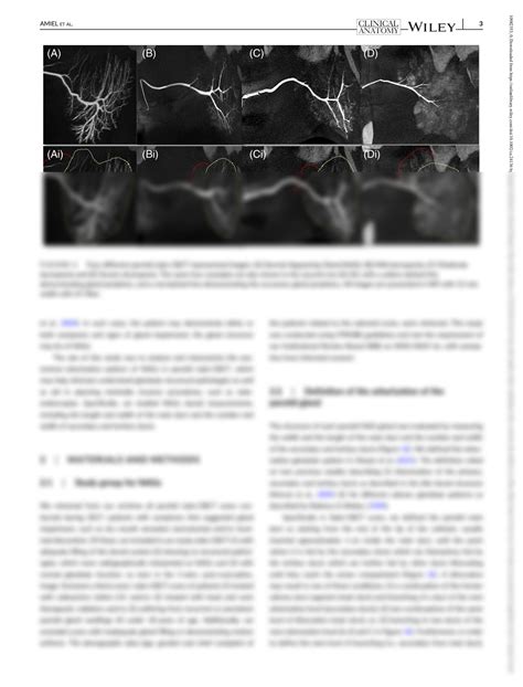 Solution Clinical Anatomy 2024 Amiel The Anatomical Pattern Of Ductal Arborization In Parotid