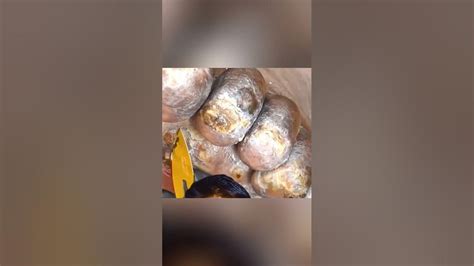 Removal Jiggers 35742 Youtube