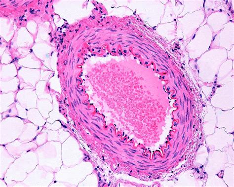 Muscular Artery 1 Photograph By Jose Calvo Science Photo Library