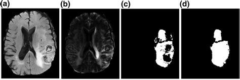 Segmentation And Postprocessing Results A Rotated Input Slice