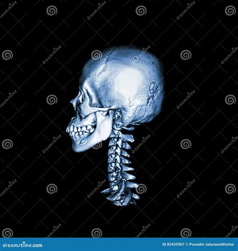 ct scan of c spine or cervical spine royalty free stock image 257208862