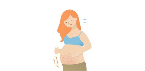 妊娠中のステロイド外用剤（塗り薬）使用｜薬局・薬店で相談できる皮膚トラブル｜ヒフシルワカル