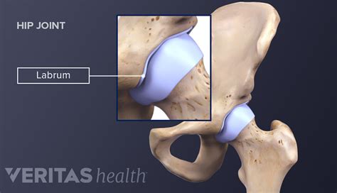 What Is The Hip Labrum Sports Health