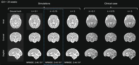 Appreciation Of The Quality Of SR Reconstruction Depending On The