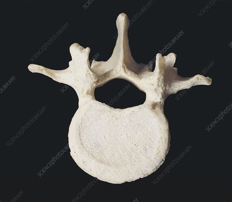 Lumbar Vertebrae L2