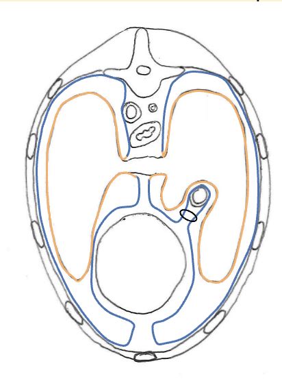 Diagram Of Lower Respiratory Tract 1 Pleura And Pleural Cavity Quizlet