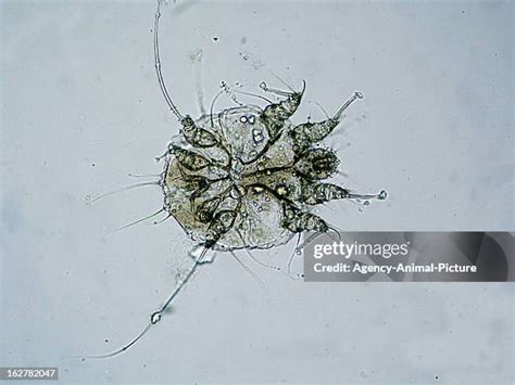 Sarcoptes Photos And Premium High Res Pictures Getty Images
