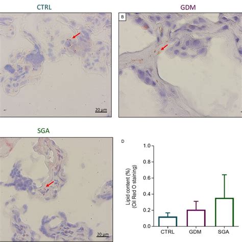 Collagen Deposition Analysis Through Histology In The Three