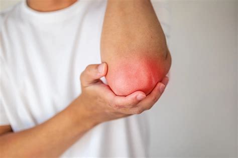 Understanding Bone Fracture Inflammation Unveiling The Impact