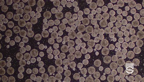 Stemcell Technologies On Linkedin Robust Scale Up Of Human Pluripotent