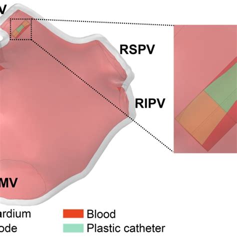 The Ablation Model Contains The La Model And The Catheter Model